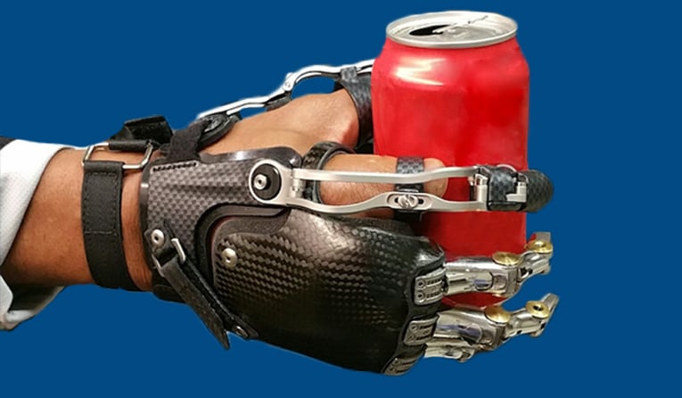 Better Choices for People with Partial Hand and Finger Loss