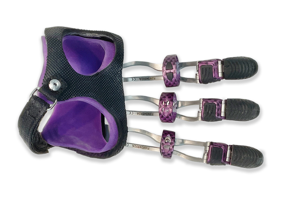 Personalized Prostheses