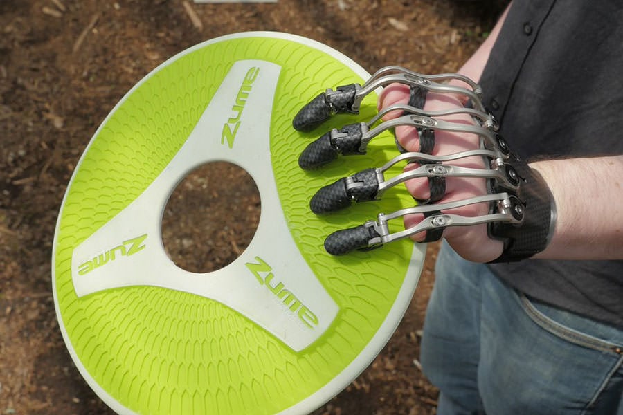 Modern, functional prosthetic solutions for finger and partial hand ...