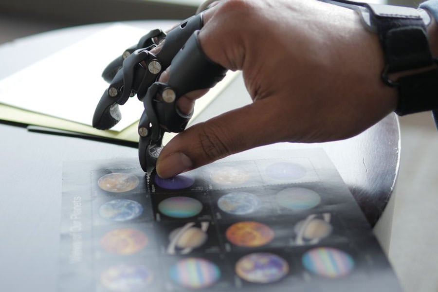 Modern, functional prosthetic solutions for finger and partial hand ...