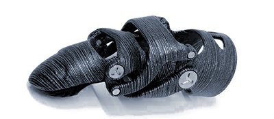 Modern, functional prosthetic solutions for finger and partial hand ...