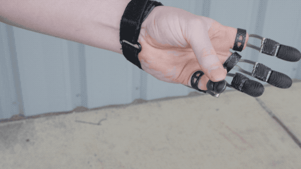 Providing the Most Unique Upper Limb Prosthetic Solutions