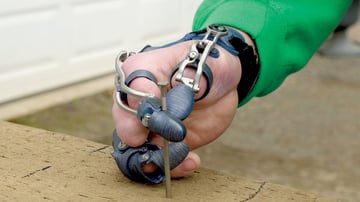 Finger and Partial Hand Prosthetic Options | Arm Dynamics