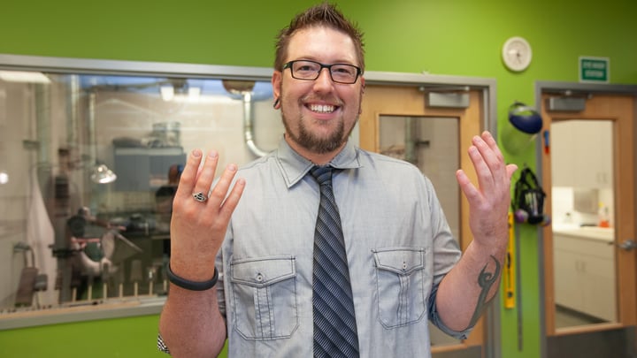 Finger and Partial Hand Prosthetic Options | Arm Dynamics