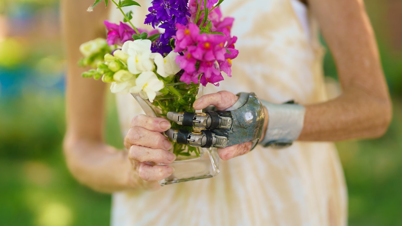 Prosthetic Options | Arm Dynamics