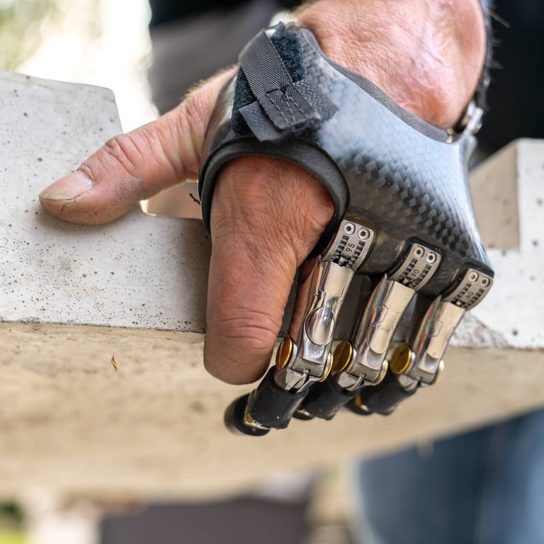 Prosthetic Technology | Arm Dynamics