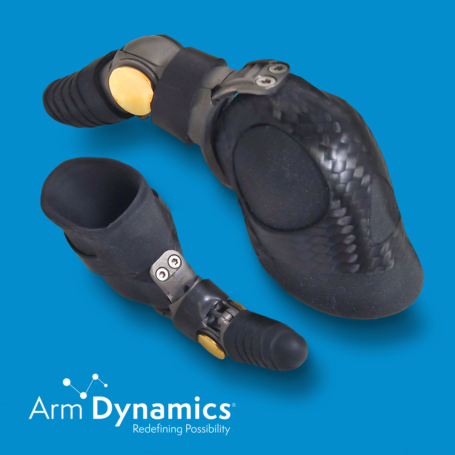 Prosthetic Options for Varying Levels of Finger/Hand Differences or Loss