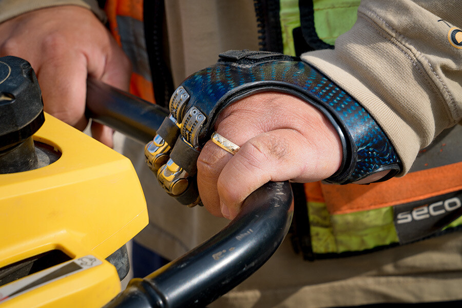 Introduction to Passive Prostheses