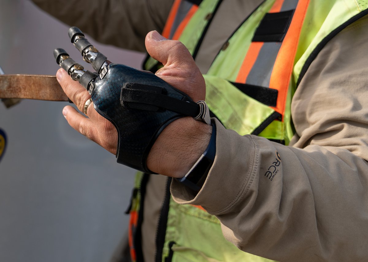 Better Choices for People with Partial Hand and Finger Loss