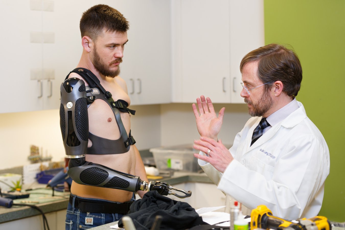 Upper Limb Specialists vs. General Prosthetic Providers | Arm Dynamics