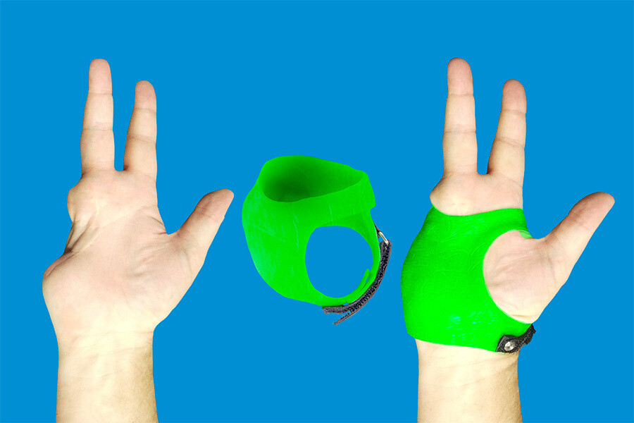 Prosthetic Options for Partial Thumb Amputations or Differences