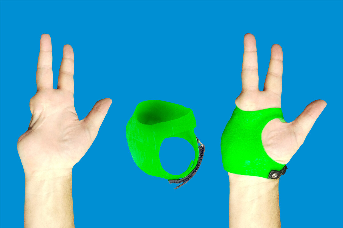 Introduction to Body-Powered Prostheses