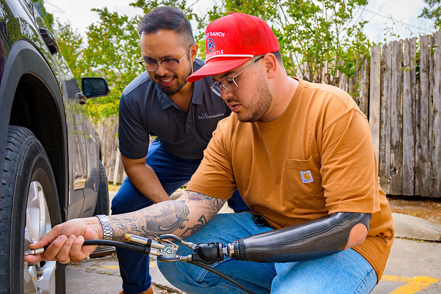 How Are Prosthetic Arms, Hands and Partial Hands Fitted?