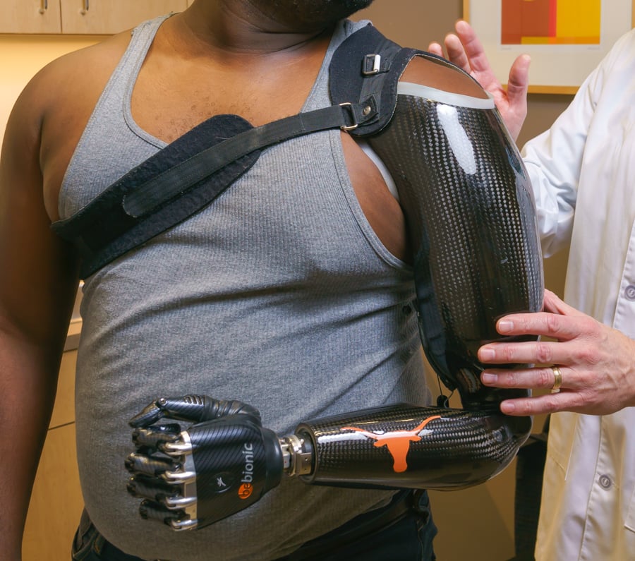 Creativity and Prosthetic Devices