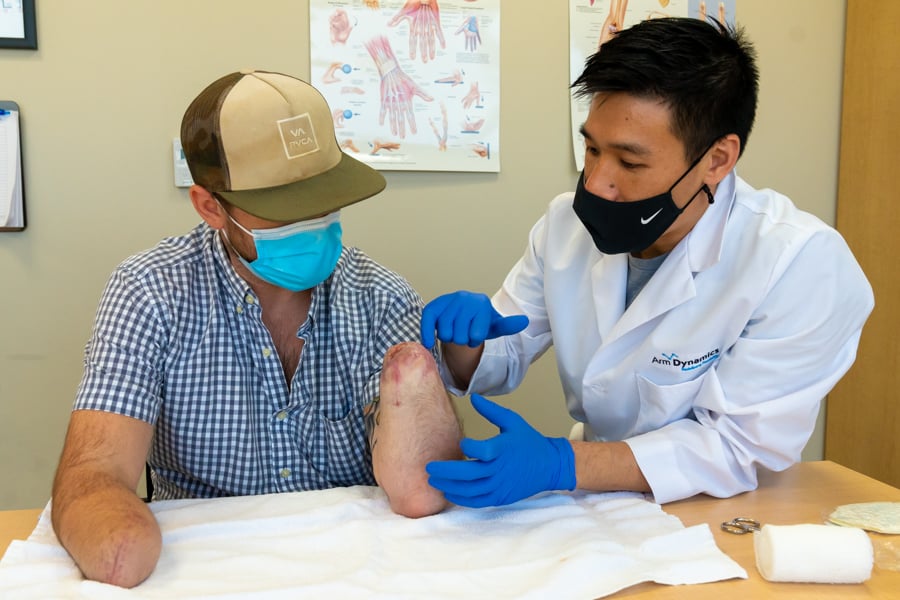 Why People Get Surgery After an Upper Limb Amputation