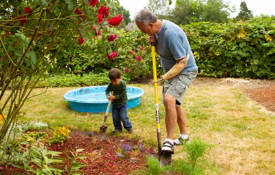 When An Amputation is the Result of a Work Accident: Introduction to ...