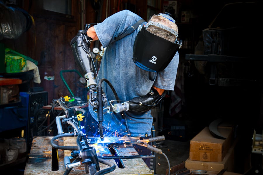 Introduction to Body-Powered Prostheses