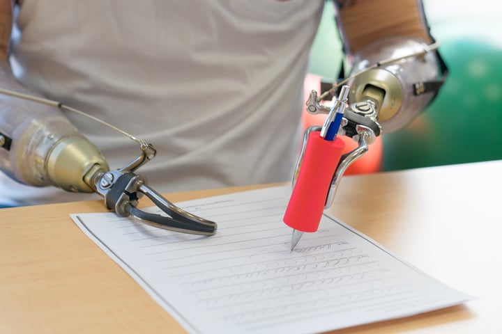 Introduction to Body-Powered Prostheses