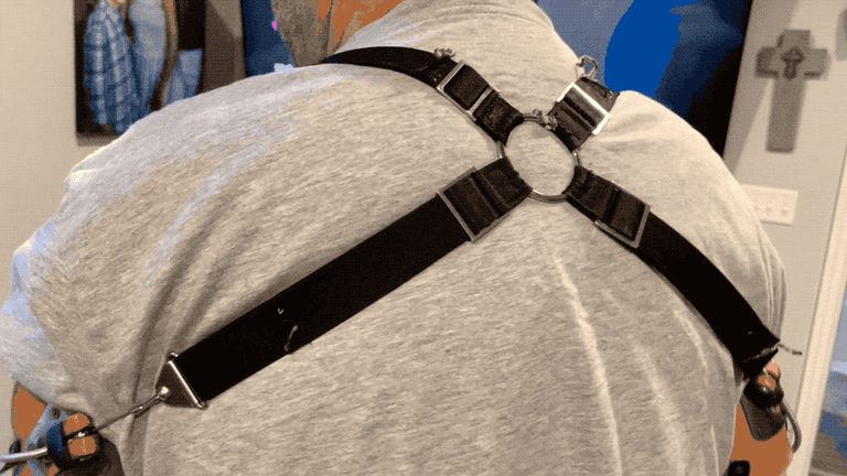 Harnesses and Upper Limb Prostheses