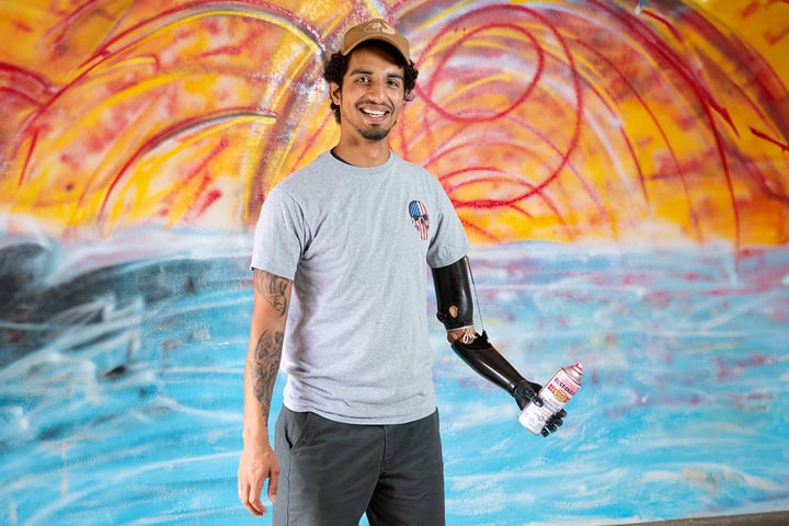 “Is Everyone Looking at Me?” Upper Limb Differences and Public Perception