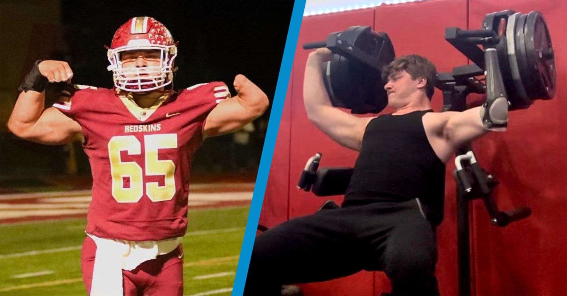 High School Football Captain, Weightlifter, Limb Different: Dakota at 17