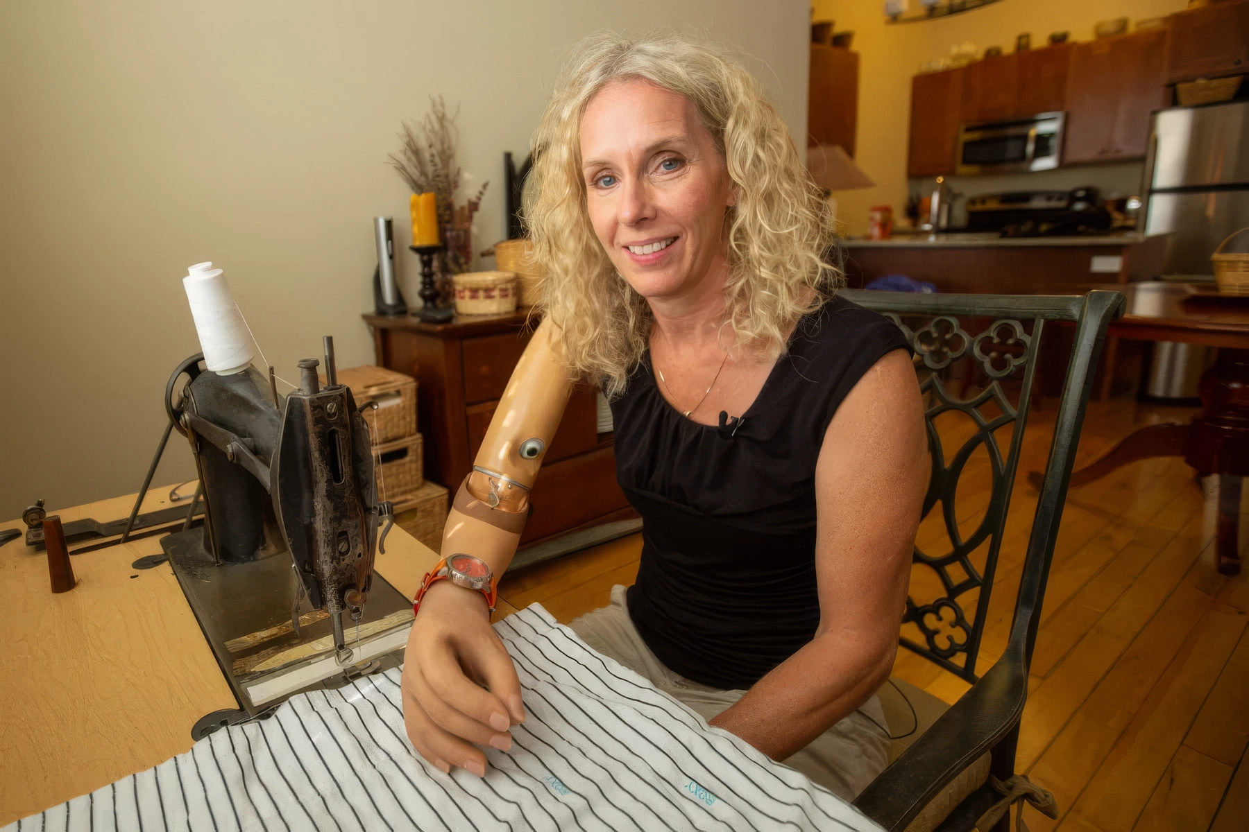 Prosthetic Terminal Devices for Babies, Children and Adolescents with ...