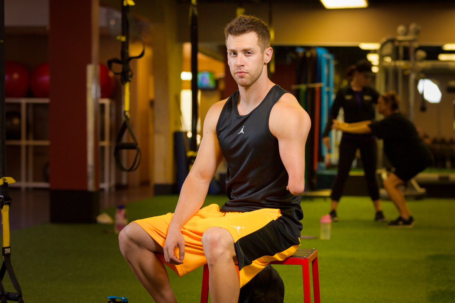 The Upper Limb Library | Below the Elbow Amputations