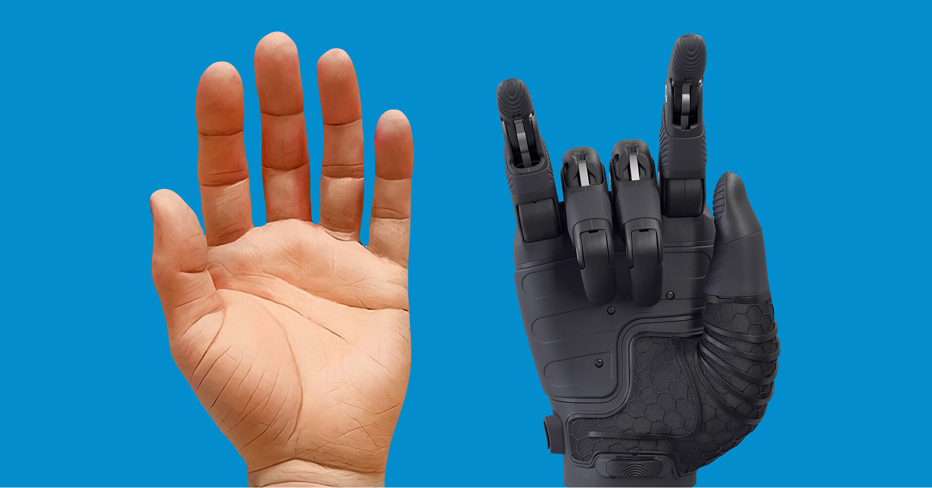 Upper Limb Prostheses That Combine Function with Realism