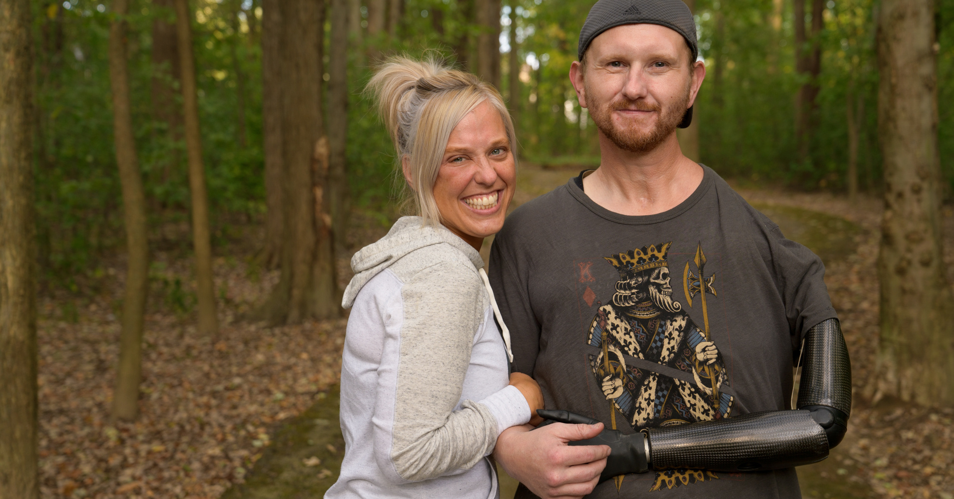 Shoulder Level Limb Differences