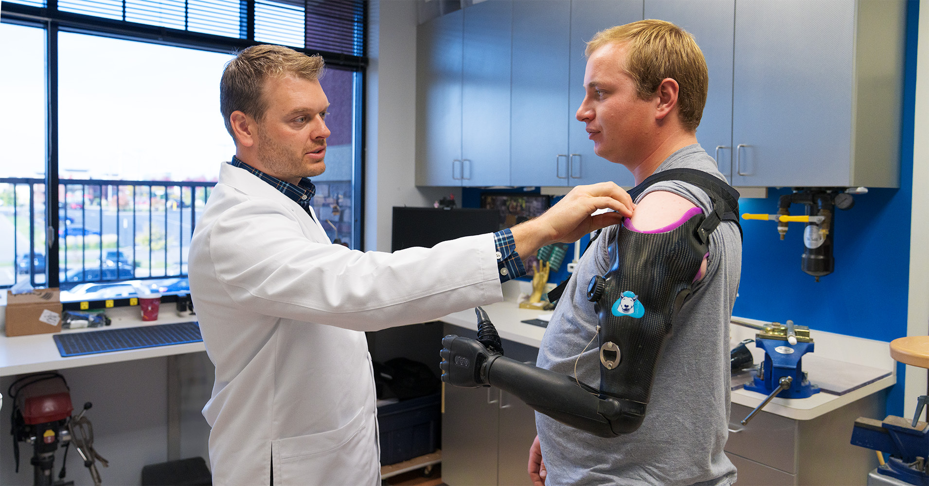 The Weight of Upper Limb Prostheses
