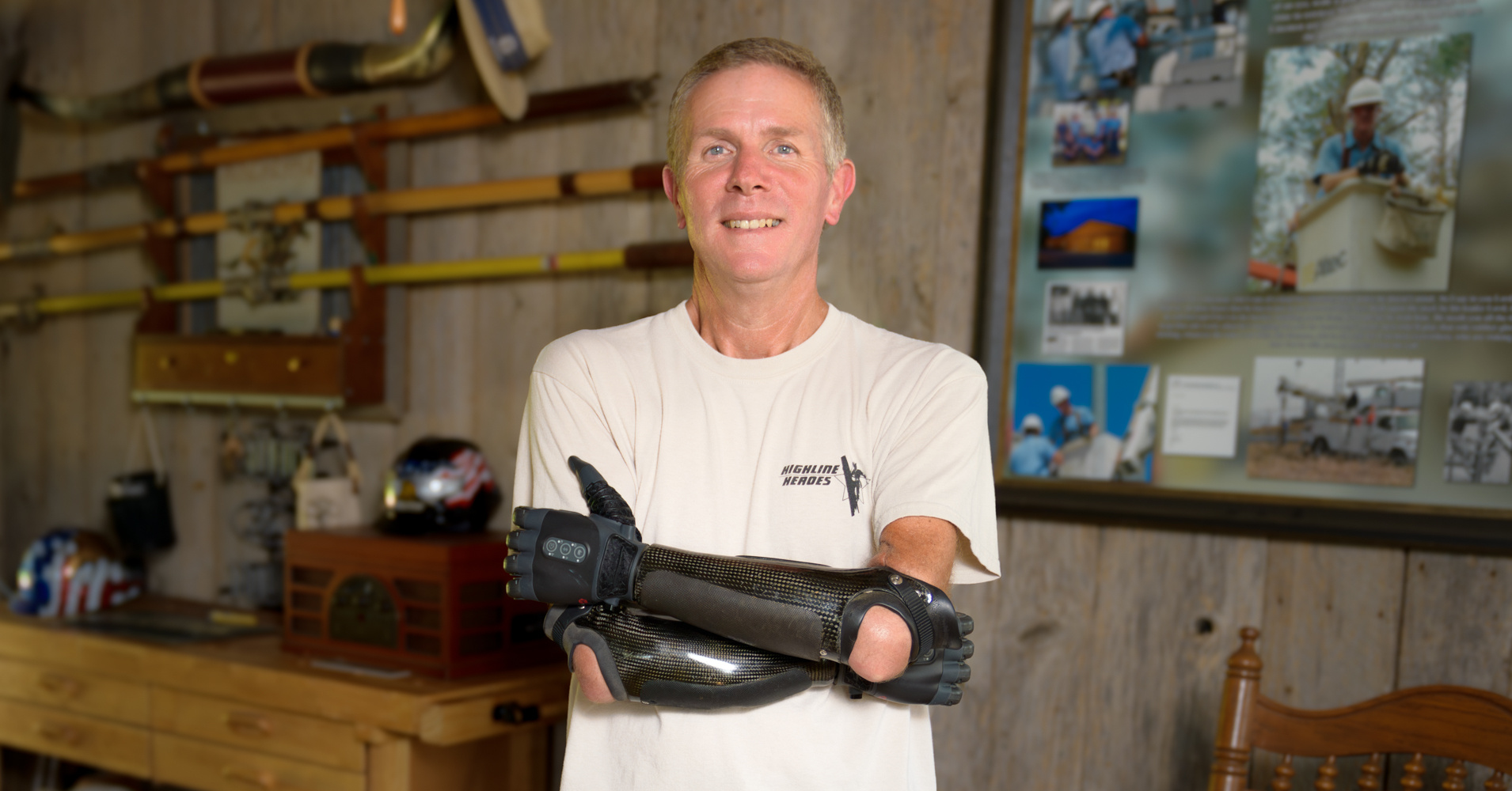 "I'm Blessed Just to be Here on the Earth": Gerry's Bilateral Upper ...