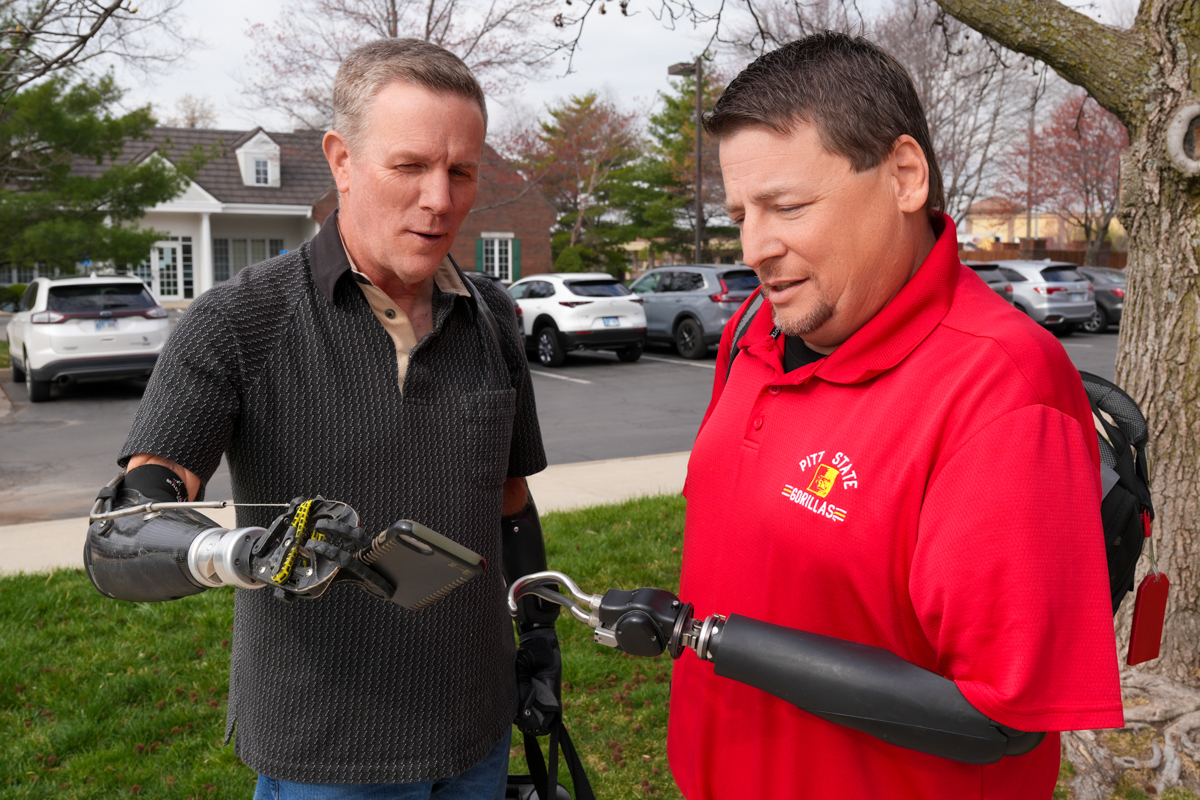 When You’re Feeling Stuck as an Upper Limb Amputee