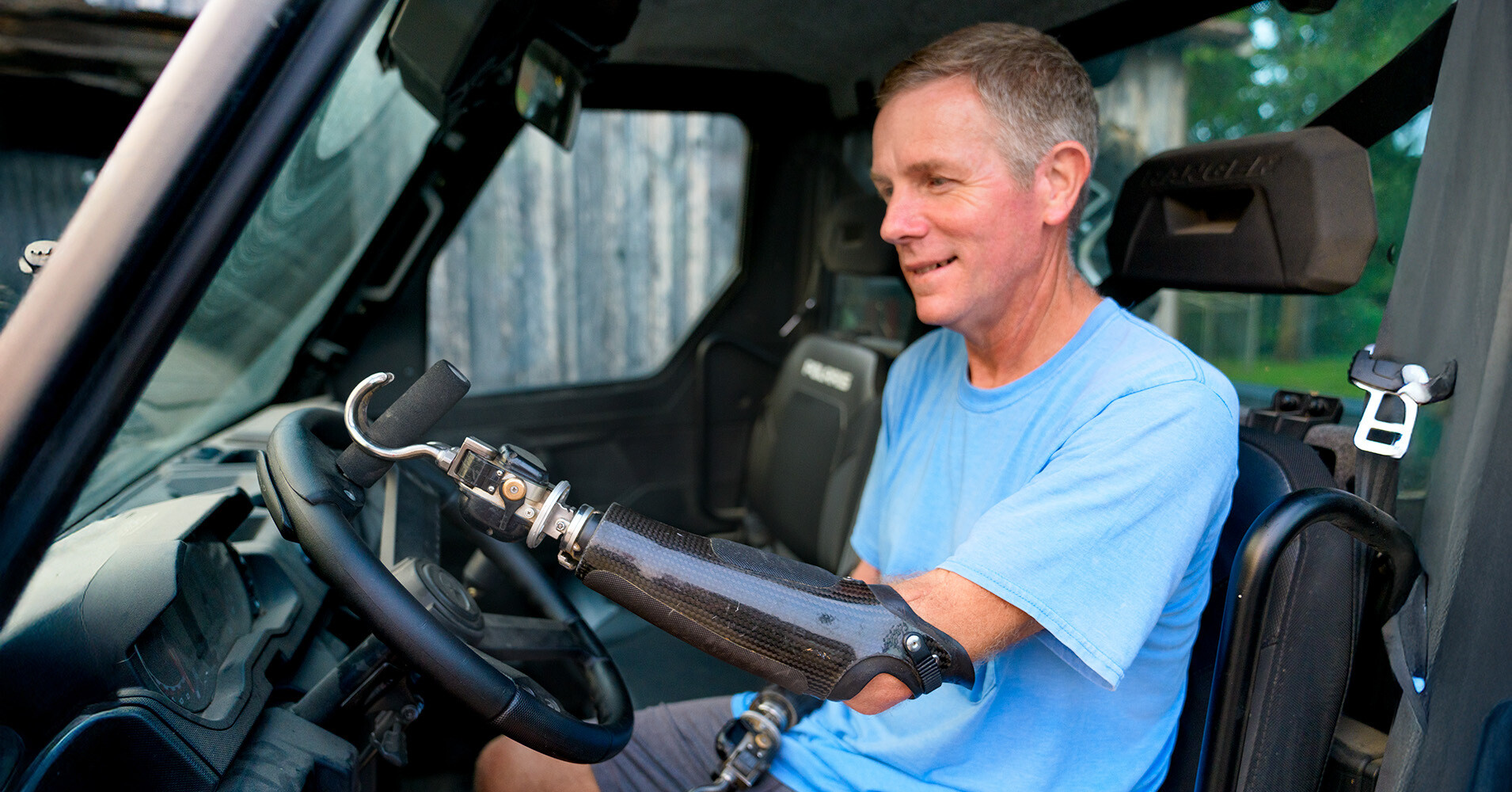 Driving After Upper Limb Loss