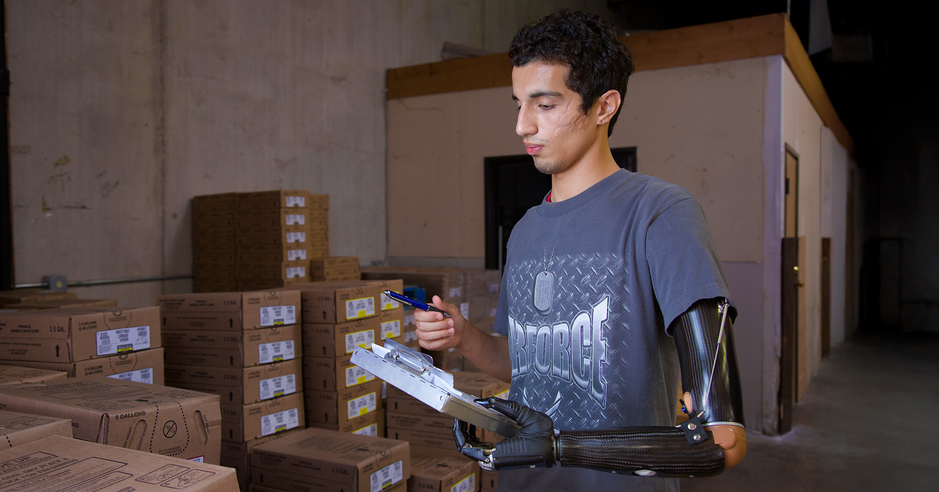 What is a Hybrid Upper Limb Prosthesis?