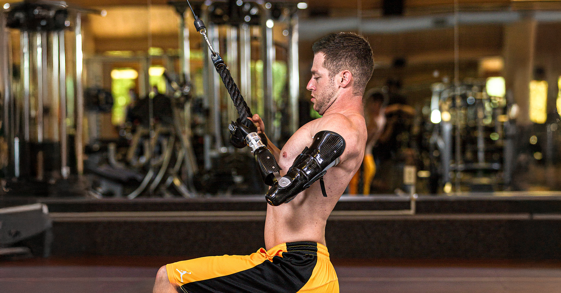 Upper Limb Prosthetic Terminal Devices for Workouts: Options and Videos