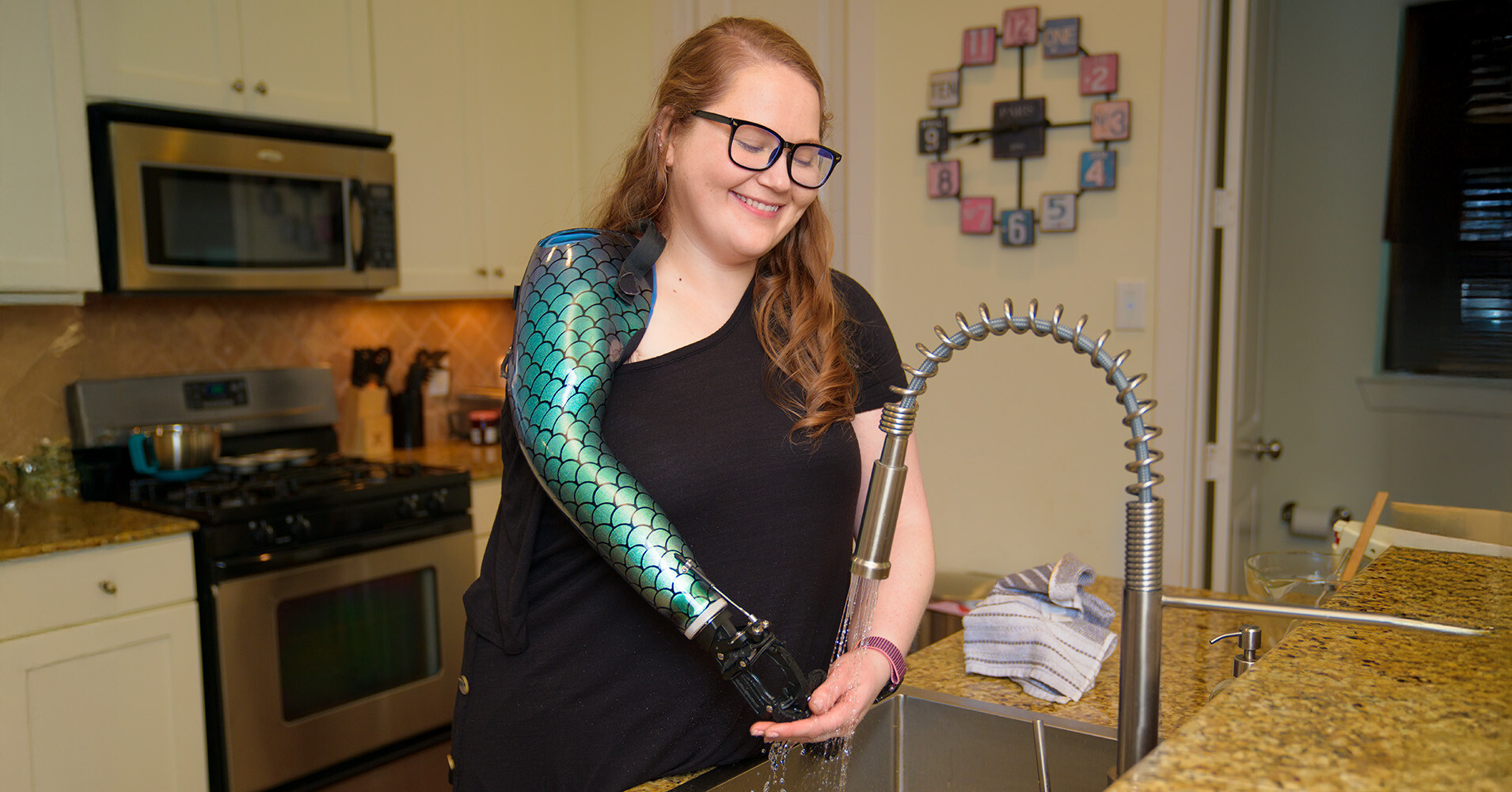 Women and Upper Limb Prostheses