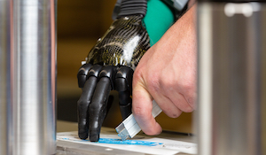 Introduction to Myoelectric Prostheses