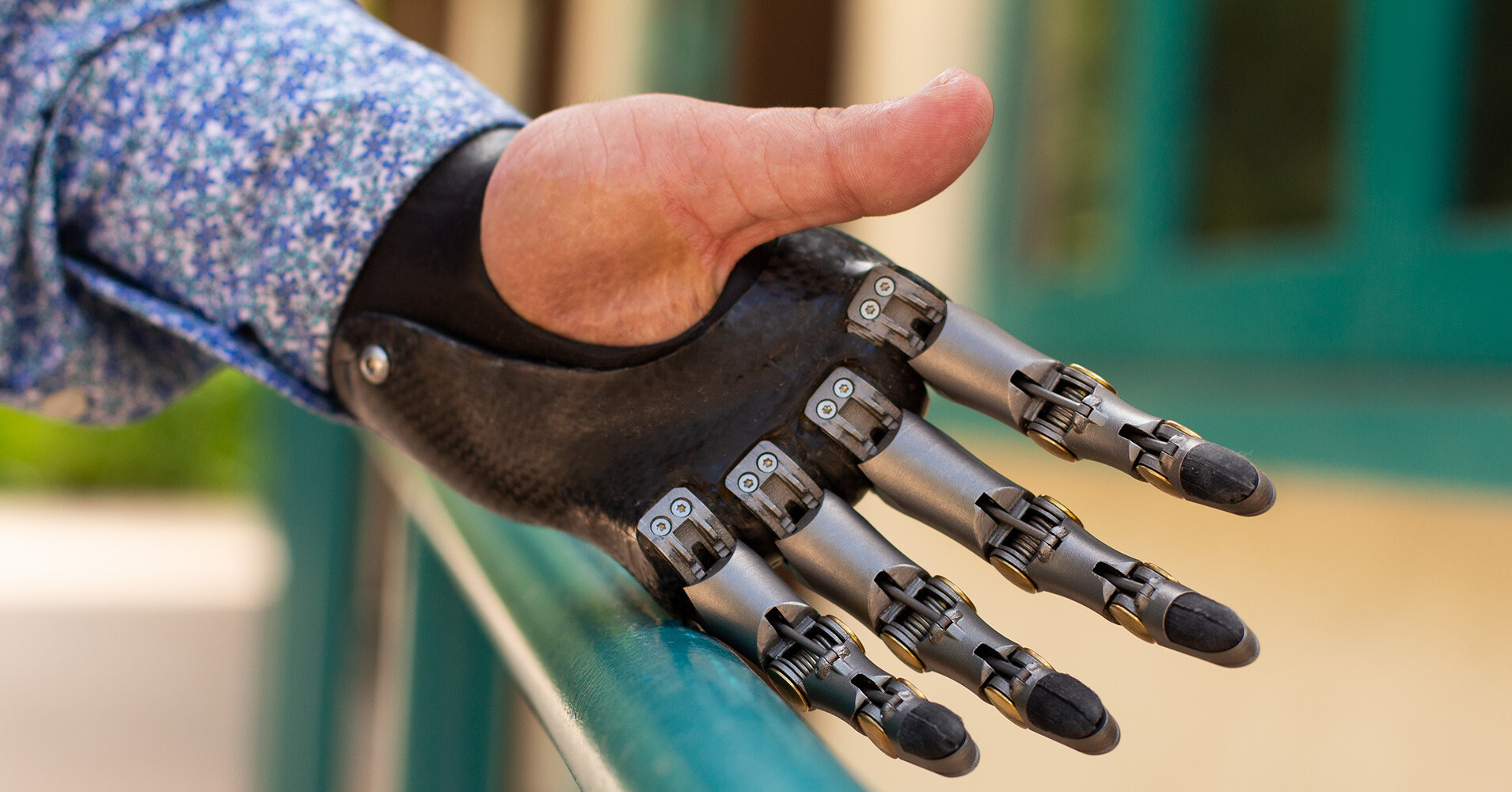 Introduction to Passive Prostheses