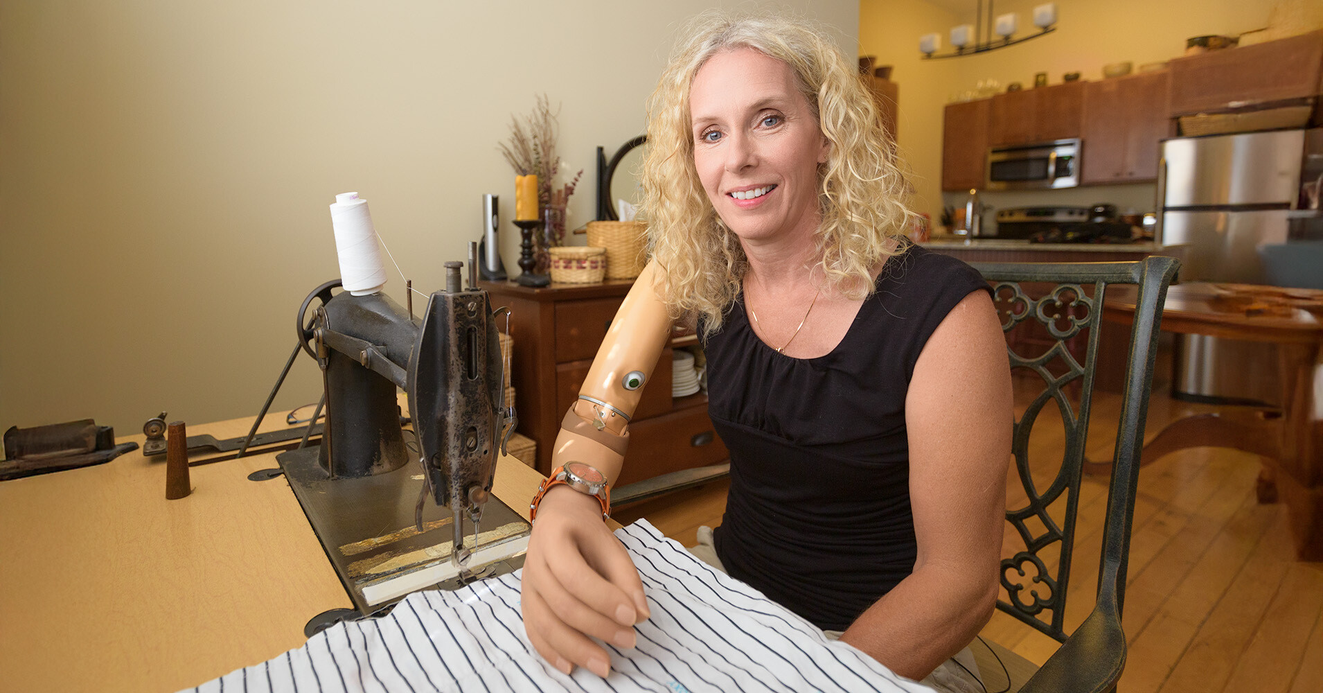 Lifelong Prosthesis Users