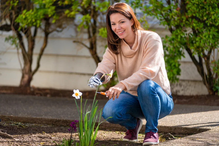 Stats and Testimonials Regarding Upper Limb Prosthetic Care and Devices