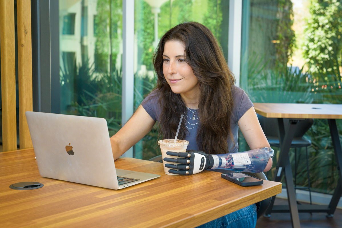 The Upper Limb Library | Congenital Limb Differences